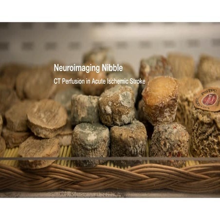 Neuro EM: Neuroimaging Nibble CTP mismatch in Acute Ischemic Stroke | PPT