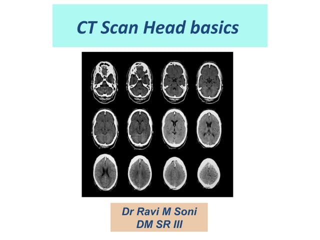 Approach to CT Head Imaging