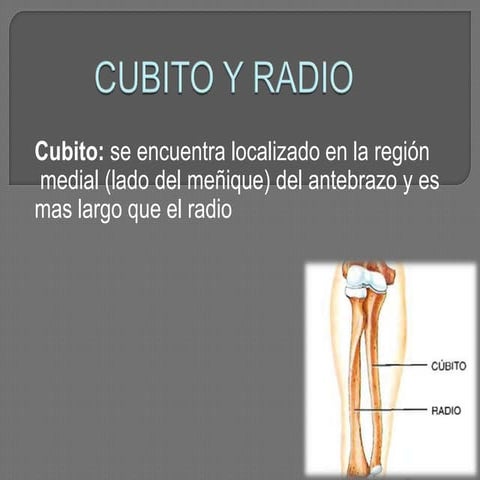 Anatomía Del Cúbito Y El Radio Indemnización Fractura De Radio