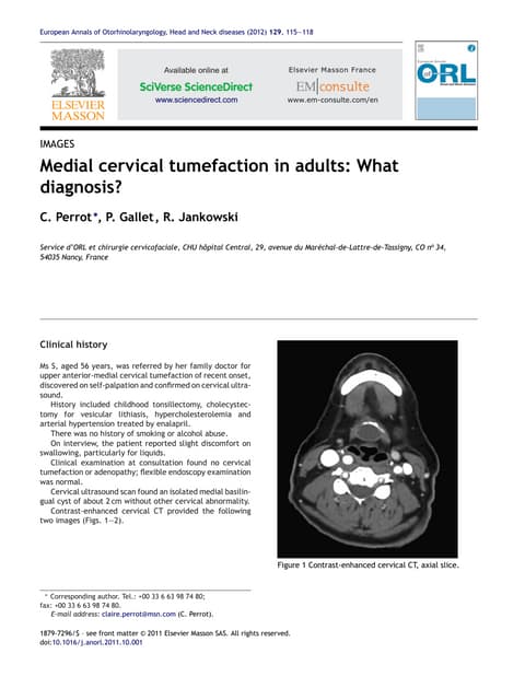 Congenital Midline Perineal Groove: A Rare Defect of Perineum | PDF