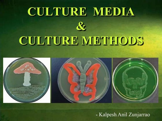 Types of culture media | PPT