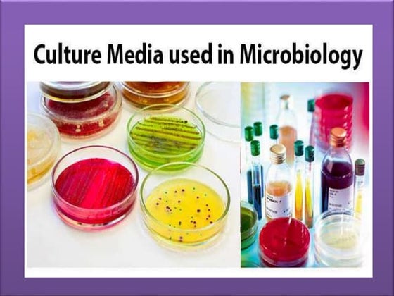 Media preparation and its types | PPTX