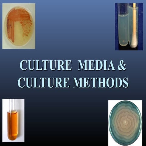 Culture media & culture methods | PPT
