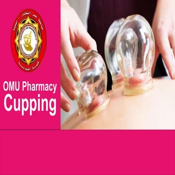 cupping حجامه.pptx