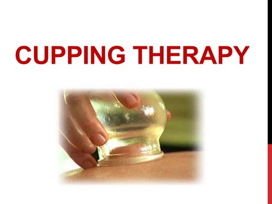 Presentation about cupping | PPTX