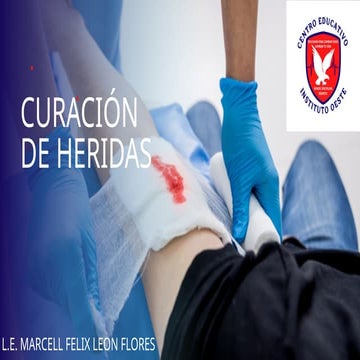 Curacion de Heridas | PPTX