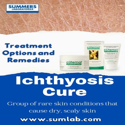 What are the most effective treatment options for managing ichthyosis ...