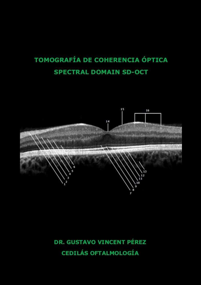 CURSO OCT SPECTRAL DOMAIN