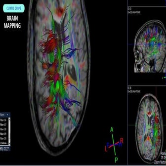 Brain mapping is the process of using imaging techniques to create ...