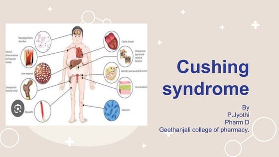 Cushings syndrome | PPTX