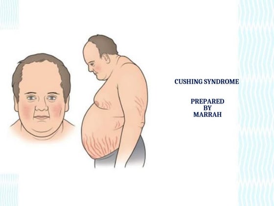 Cushings_Syndrome_Illustrated_Detailed.pptx