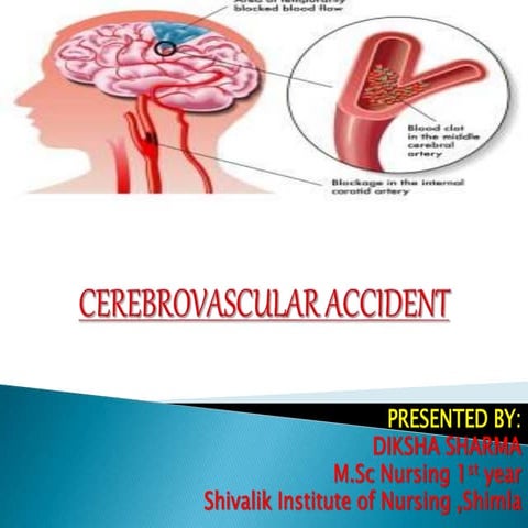 CVA - Cerebrovascular Accident / Stroke | PPTX