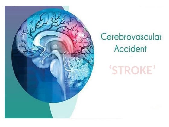 Case Study on Cerebro Vascular Accident (CVA) | DOCX | Brain and Nervous System Disorders ...