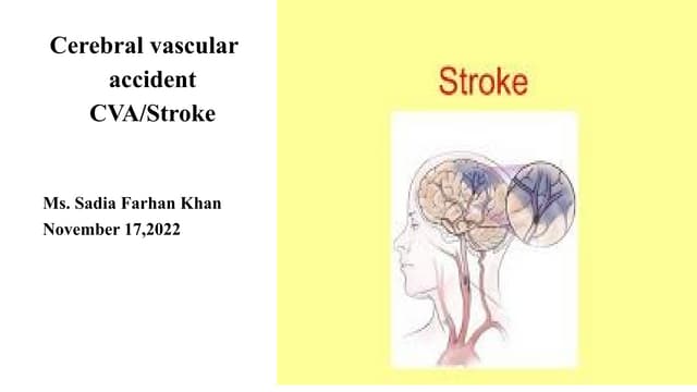 CVA - Cerebrovascular Accident / Stroke | PPTX | Blood Disorders ...