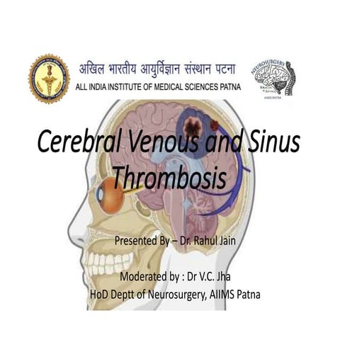 Cerebral Venous thrombosis.pptx