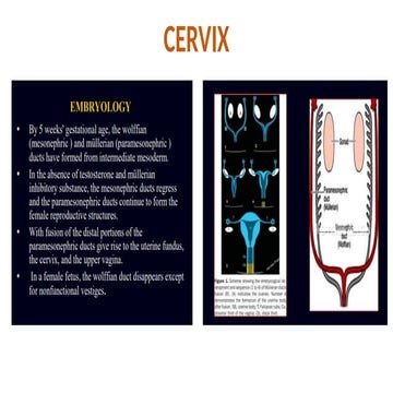 Cx lesion benign and malignant and their management | PPTX