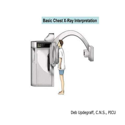 Chest x ray | PPT