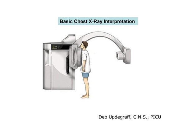 X Ray: Chest-Homogenous opacity | PPT