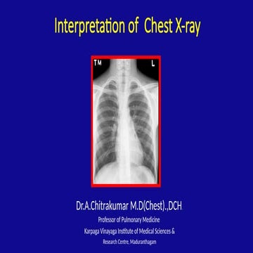 Chest X-rays for Undergraduates | PPTX