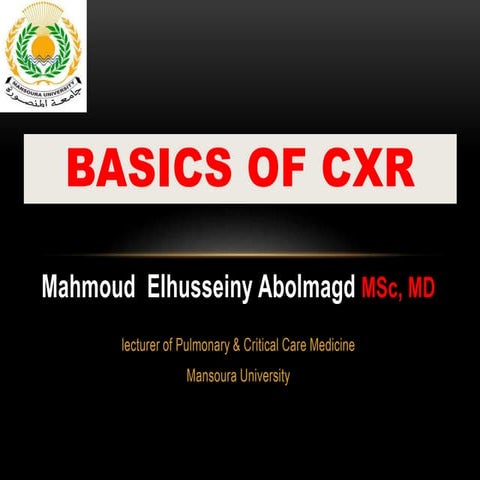 Basics of CXR | PPTX