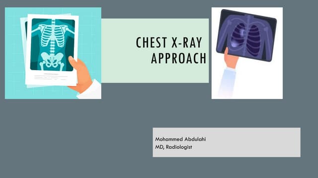 Chest radiography ppt | PPTX | Death, Injury, or Military Conflict | Sensitive Topics