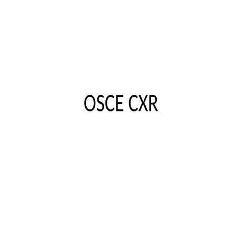 CXR OSCE.pptx in examination point of view | PPTX