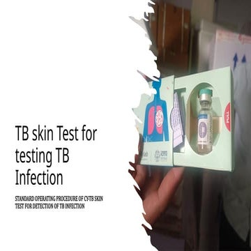 Cy TB standard operating procedure in India | PPTX