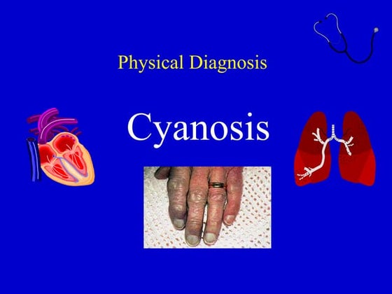 Cyanosis & nail abnormalities | PPT