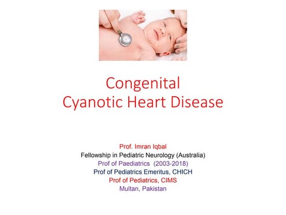 Congenital heart disease 2021 | PPT