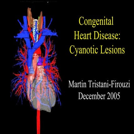 Cyanotic Heart Disease | PPT