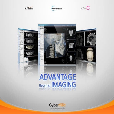 SMoP Guided Surgery Solution | PPT