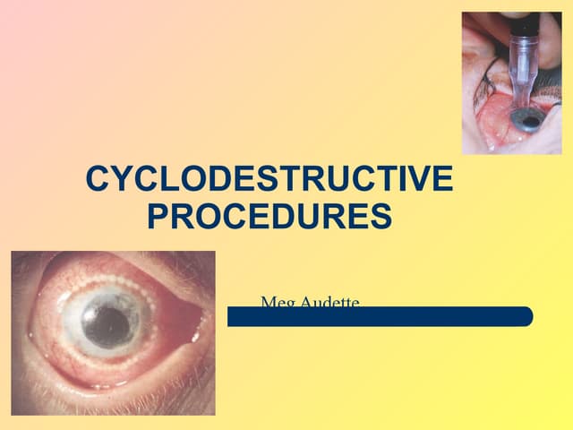 Cyclocryo | PPTX