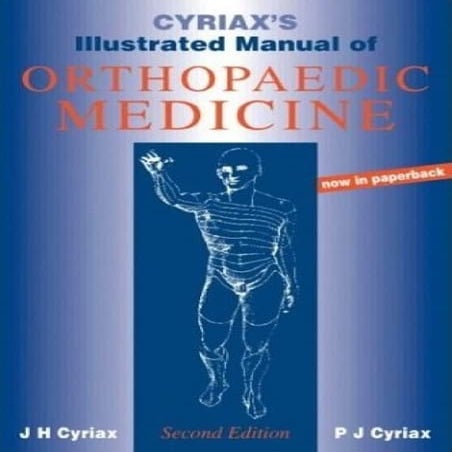 Tecnica Cyriax | PDF