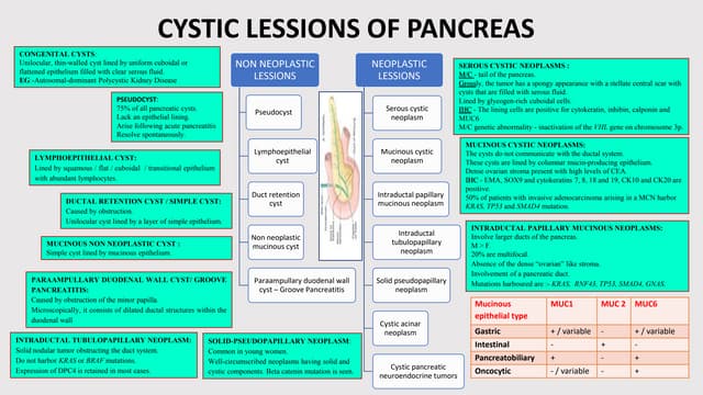 Cystic Lesion Of Pancreaspptx
