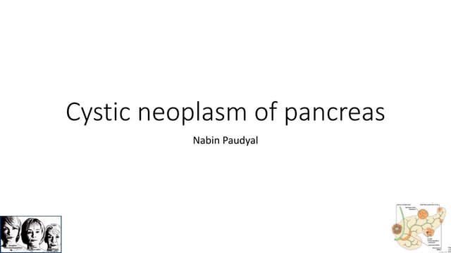 Cystic neoplasm of pancreas | PPTX