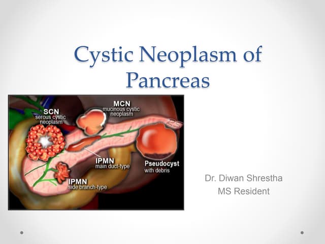 Mucinous Cyst On Pancreas
