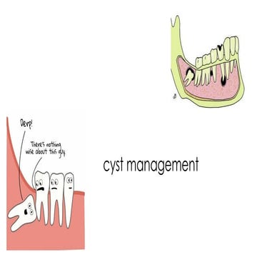 Management of cyst | PPTX