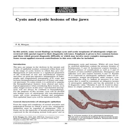 Cysts and cystic lesions | PDF