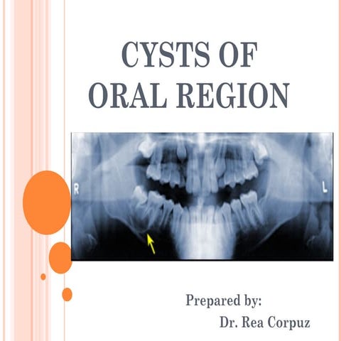 Cysts of oral region (5) | PPT
