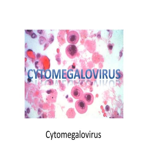 Cytomegalovirus | PPTX