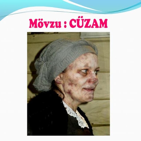 Cüzam | PPT