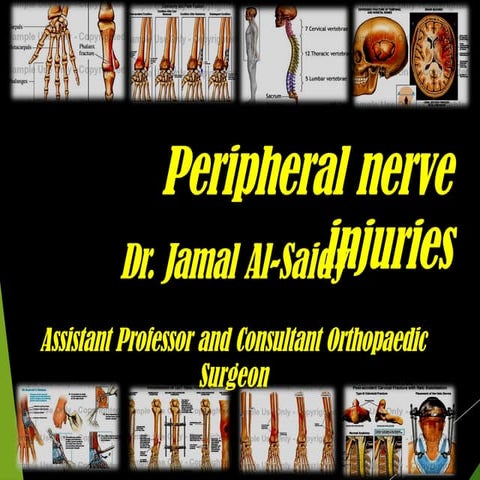 D. Jamal Peripheral nerve injuries-1 (Muhadharaty).pptx