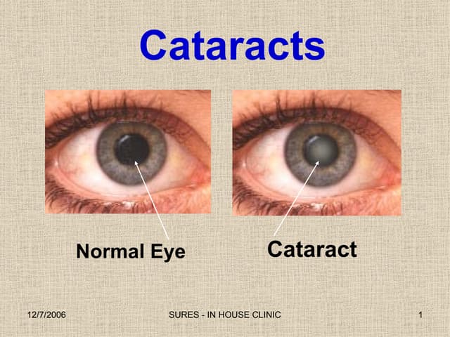 0867968 Captured In The Eye | PDF