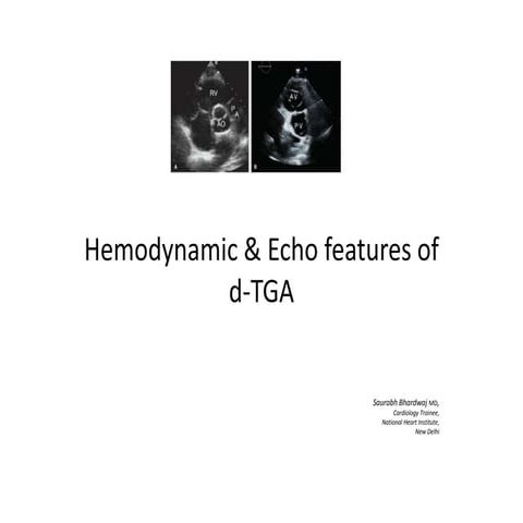 D tga, echo & hemodynamic features of | PPTX