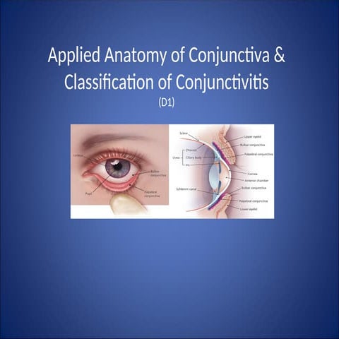 D1 - Applied Anatomy of Conjunctiva & Classification of Conjunctivitis.ppt