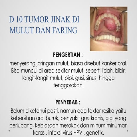 penjelasan terkait penyakit tumor yang dialami manusia.pptx