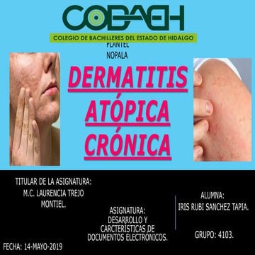 Dermatitis Atópica Crónica | PPTX