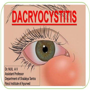 Dacryocystitis with medical and surgical management | PDF