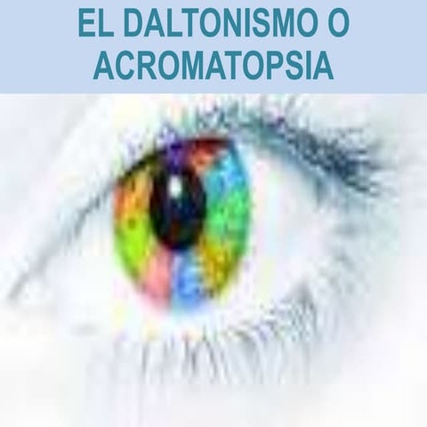 Daltonismo o acromatopsia | PPTX