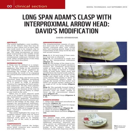 clasps in removable orthodontic appliance | PPTX